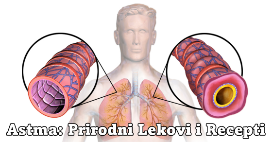 Alergijska astma simptomi i prirodno lečenje - Zdrava i lepa